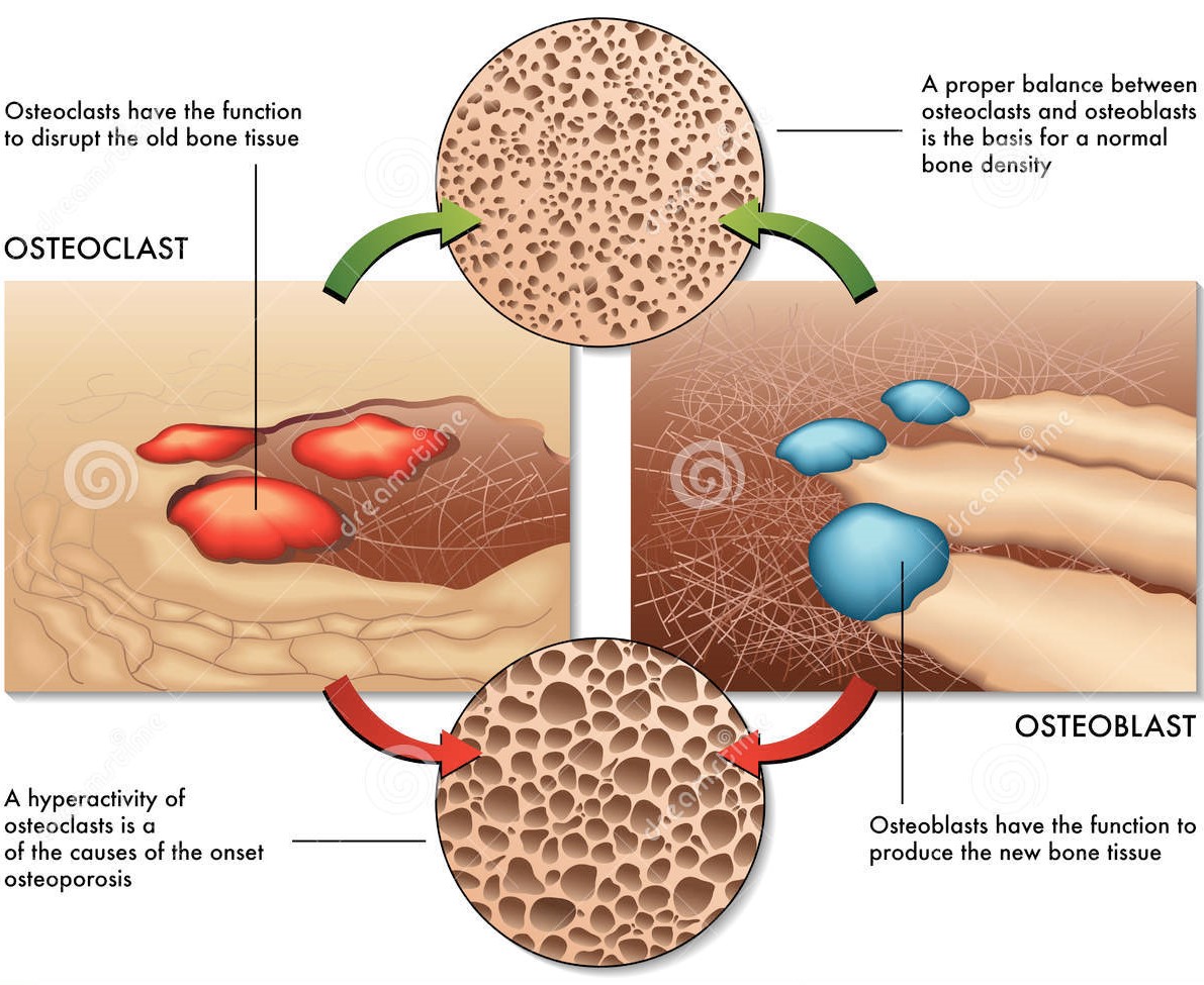 Mokslo naujienos: maliarija gali silpninti kaulus ~ Mikrobiologija ...