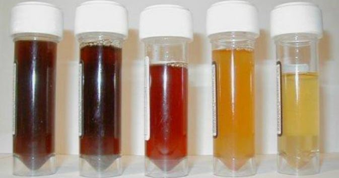 Warna Urine dan Tinja Pengaruhi Kesehatan Anda - BLOGNYA KHOIR