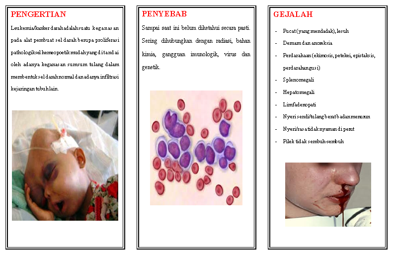 LEAFLET MARI MENGENAL PENYAKIT LEUKEMIA PADA ANAK