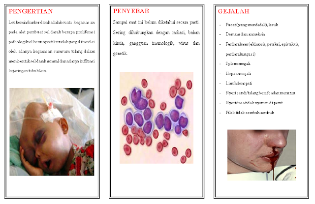 LEAFLET MARI MENGENAL PENYAKIT LEUKEMIA PADA ANAK