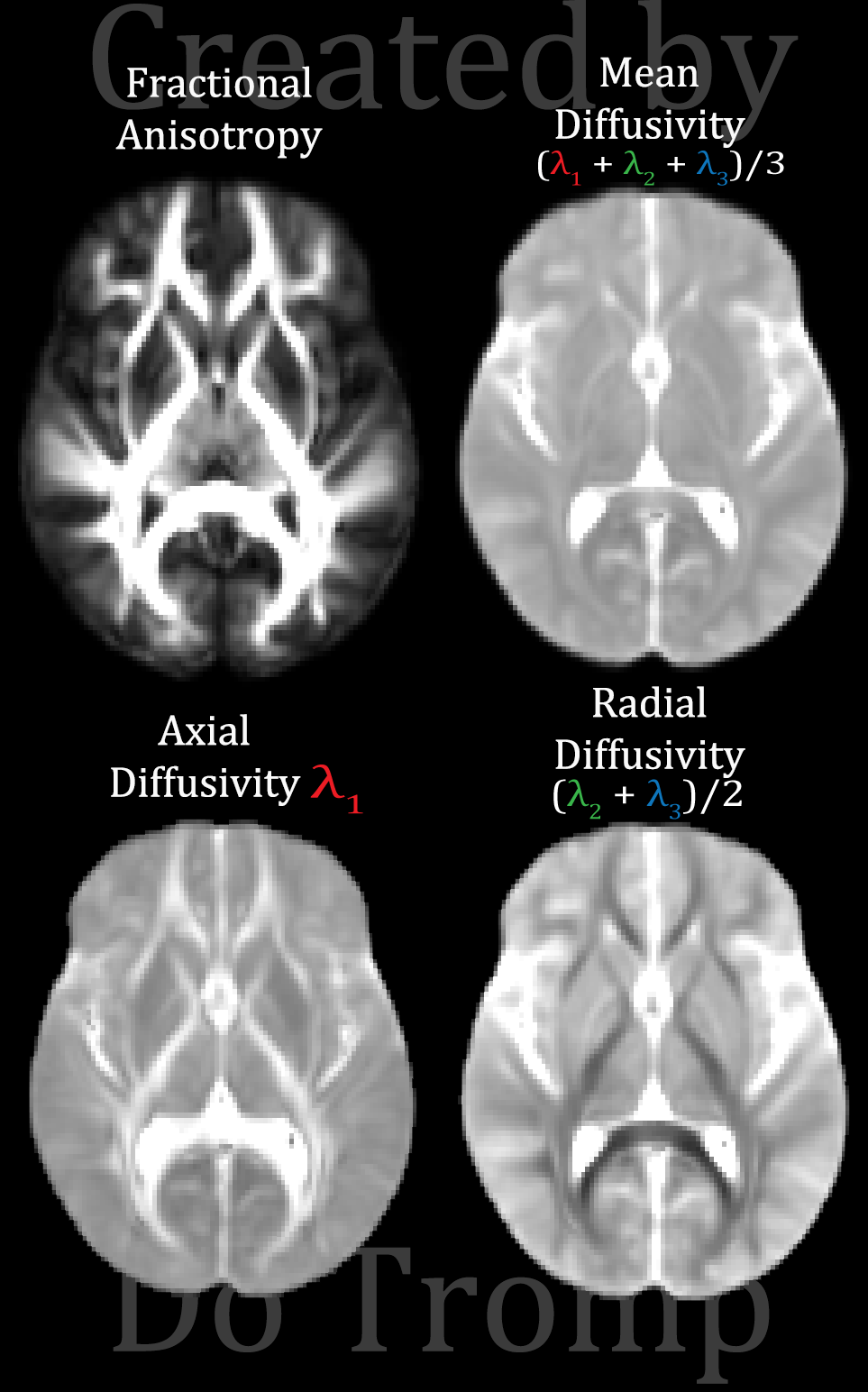 DTI Scalars (FA, MD, AD, RD) - How do they relate to brain structure? | Diffusion Imaging ...