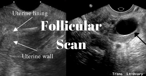 What Follicle Scan Scans for, A Complete View On it