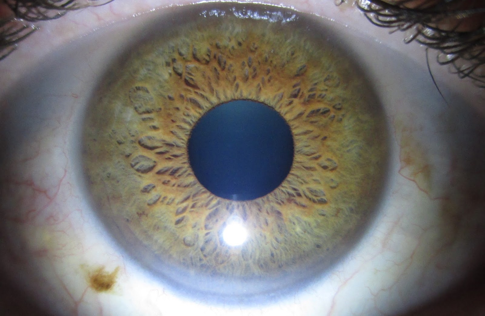 A COR DAS IRIS E SEU SIGNIFICADO