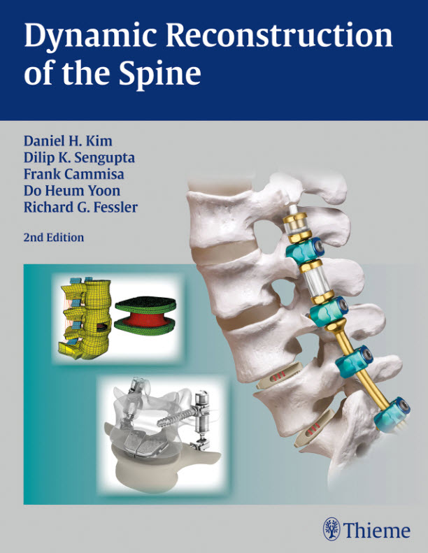 Dynamic Reconstruction of the Spine ~ berrytokojurnal