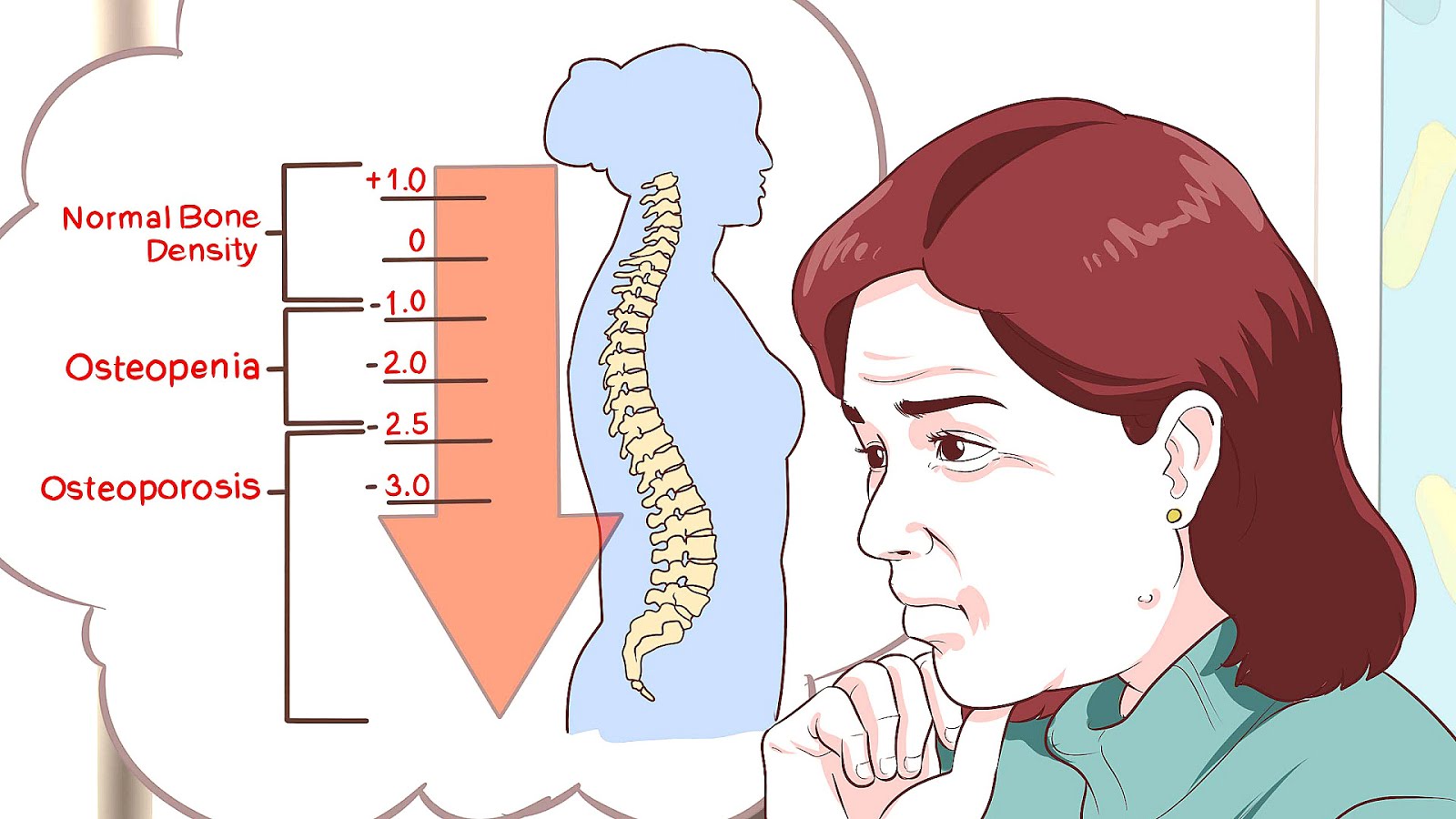 Menopause And Bone Loss - Menopause Choices