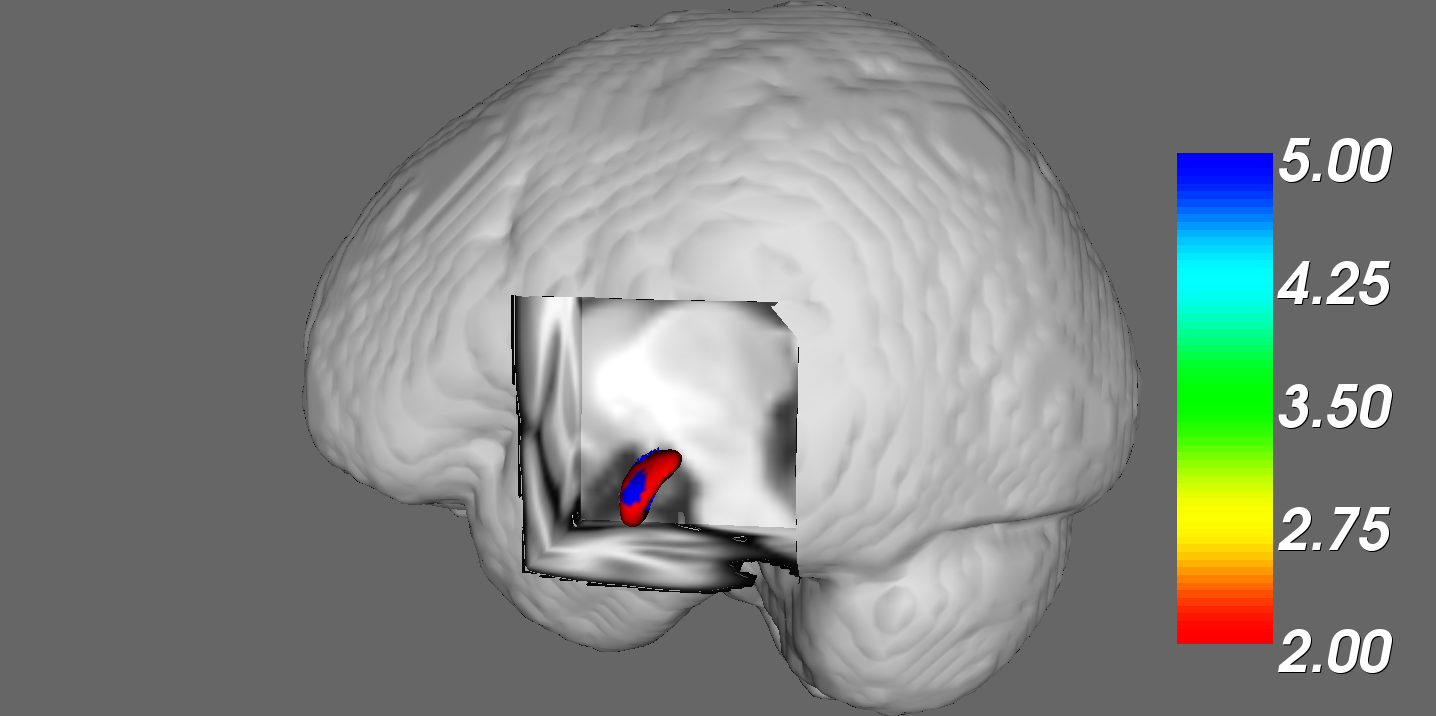 Neuroimaging Made Easy : Batching FSL tools and utilities using ...
