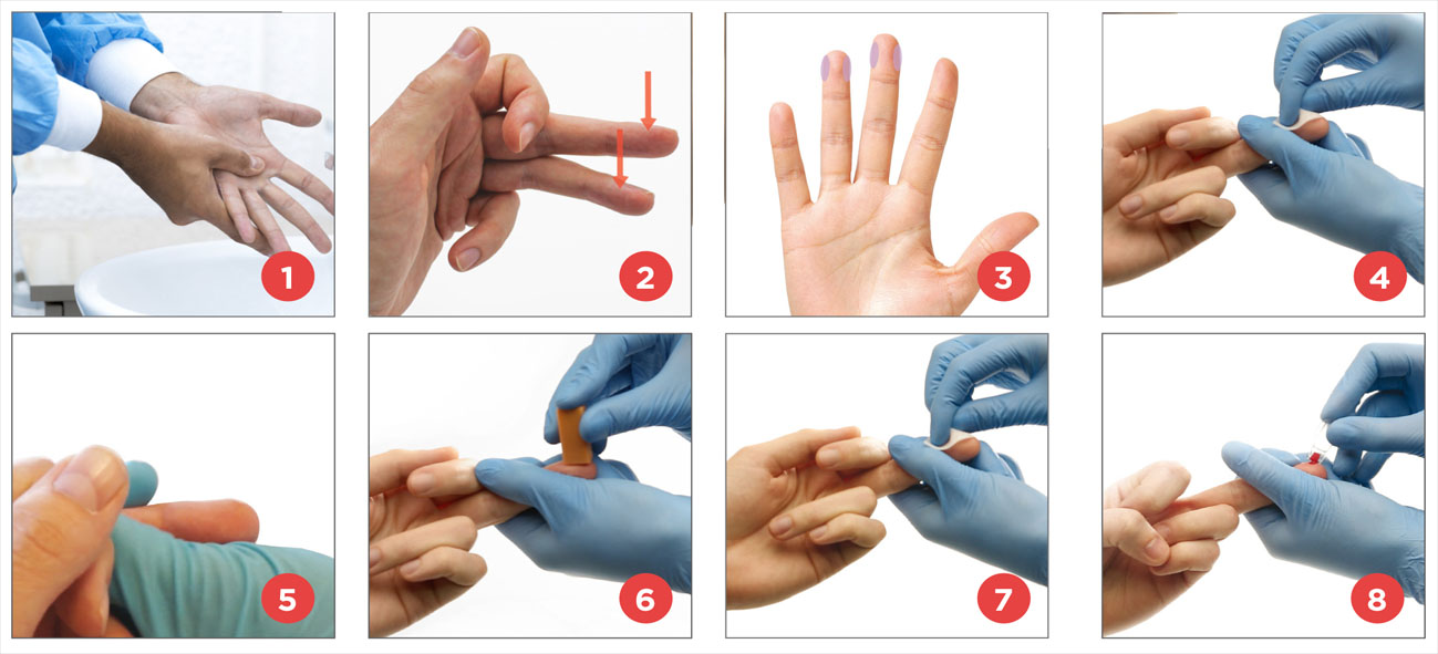 OBTENCIÓN DE MUESTRAS DE SANGRE