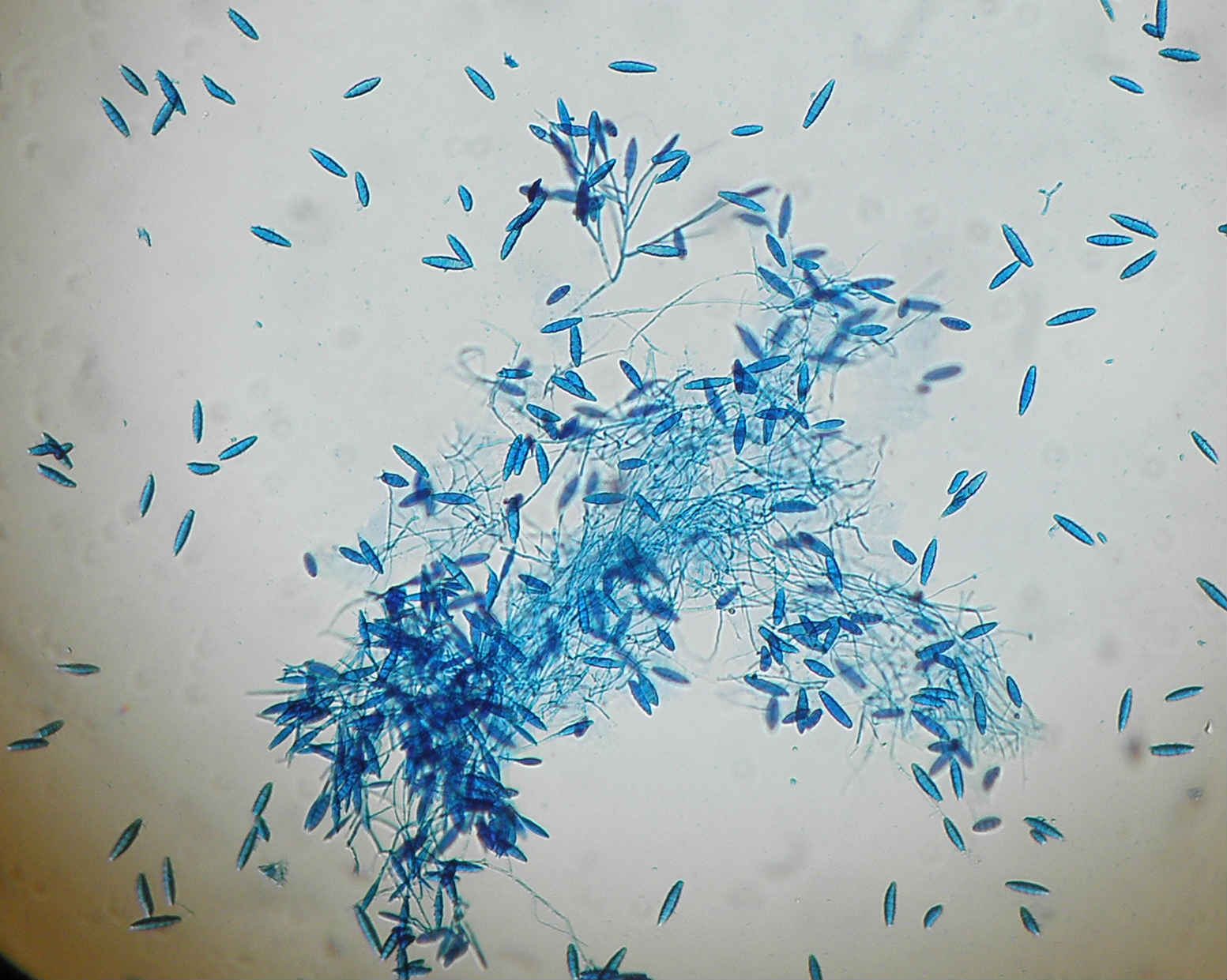 ATLAS MICOLOGIA: MICROSPORUM GYPSEUM