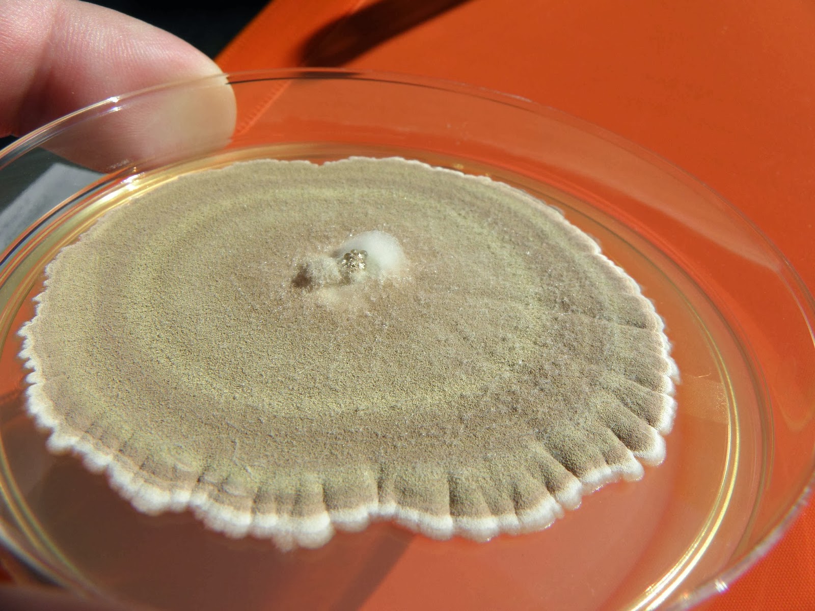 ATLAS MICOLOGIA: ASPERGILLUS TERREUS - 2 NOVAS ESTIRPES