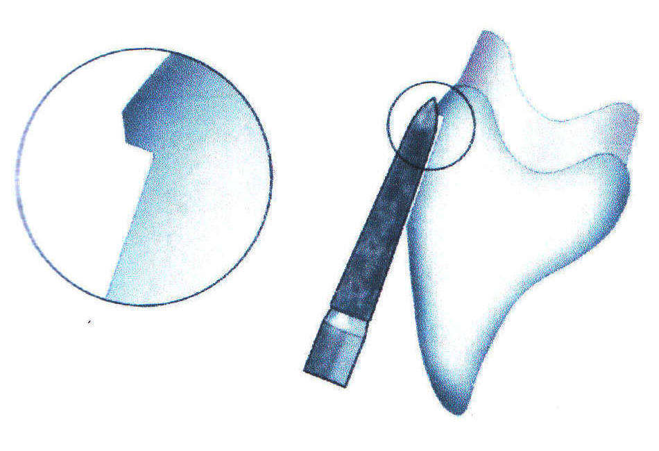 Muito bom esse café !: Linhas de terminações ( Prótese Fixa)