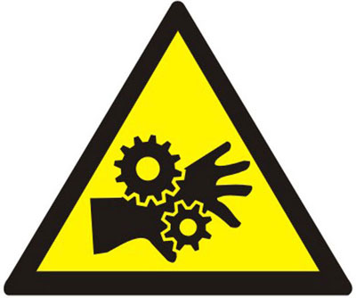 Lizbeth López Santiago 504 : 30. Machucones o aplastamiento