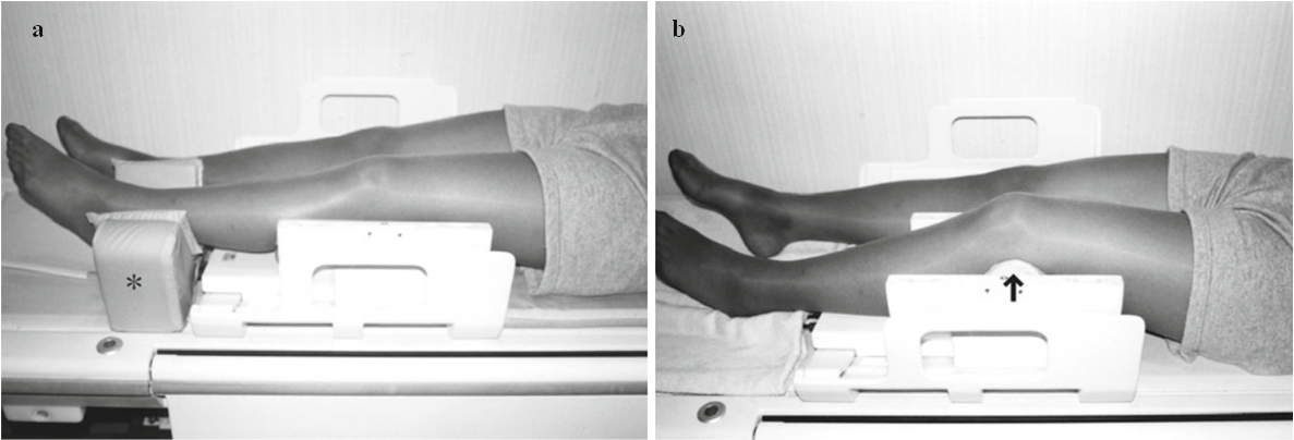 MRI Dây Chằng Chéo Trước (ACL)