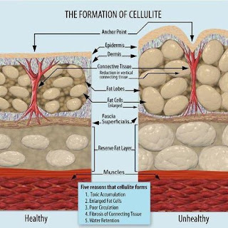 Nuala Woulfe Beauty: What Is Cellulite?