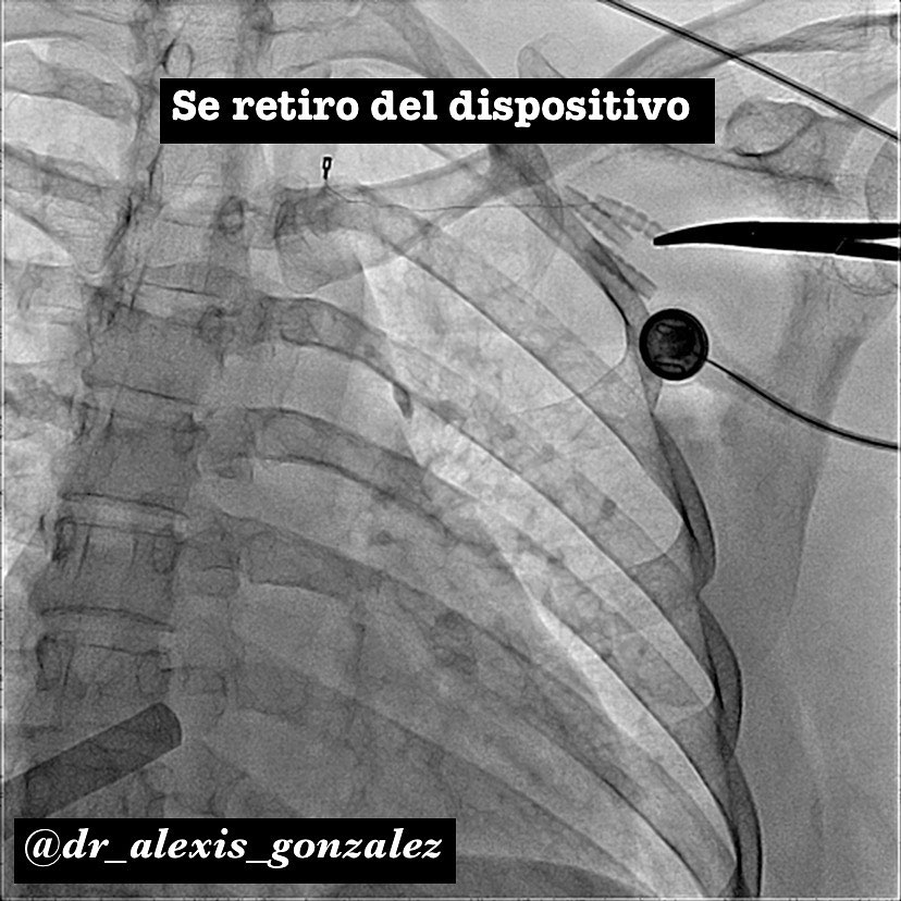 EL RINCÓN DE LA MEDICINA INTERNA. juanpedromacaluso@yahoo.com.ar ...