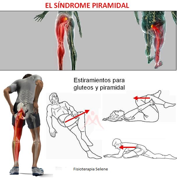 Fisioterapia Selene: FALSA CIÁTICA--CIÁTICA POR SÍNDROME DEL PIRAMIDAL