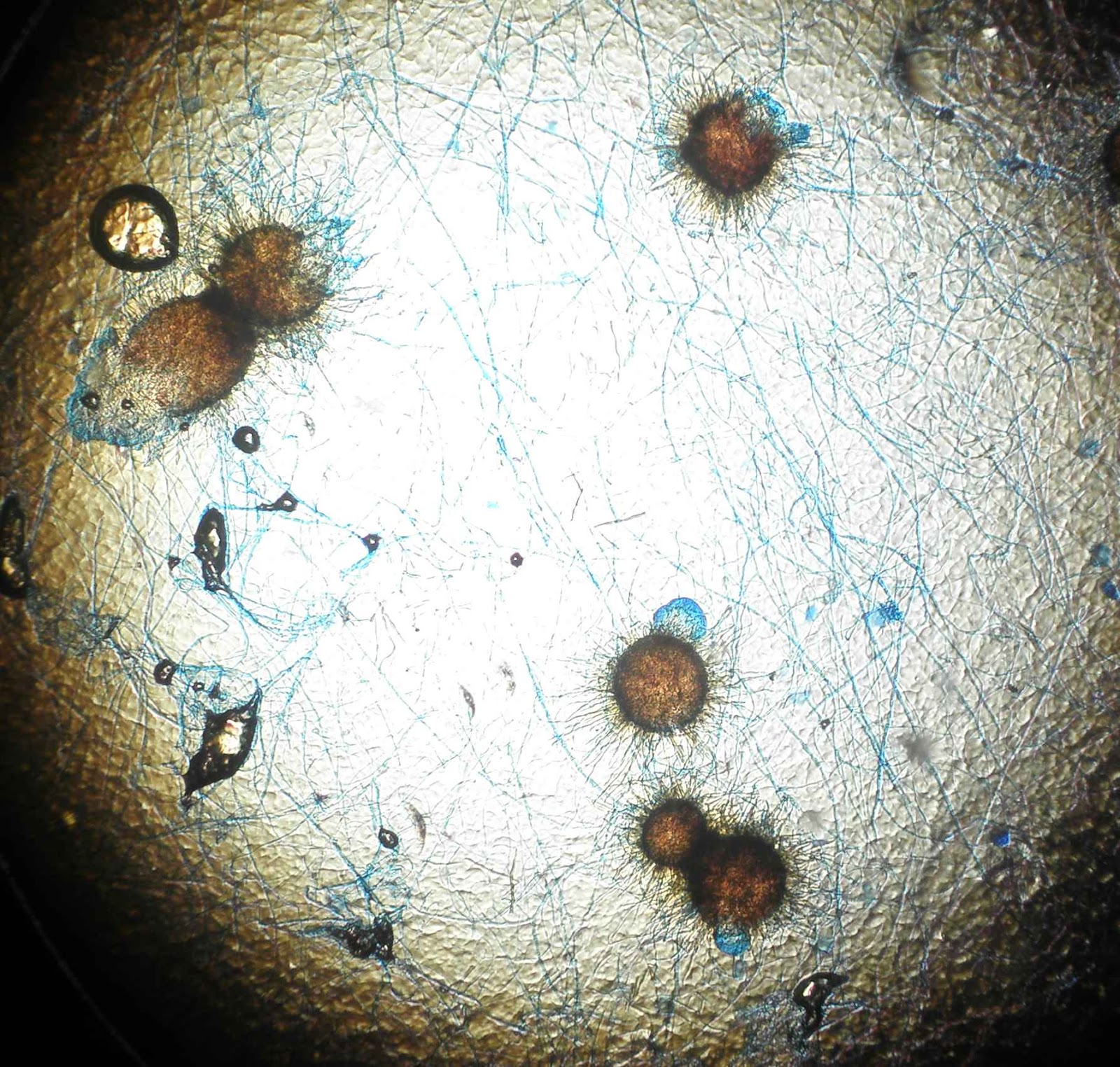 ATLAS MICOLOGIA: CHAETOMIUM SPECIES