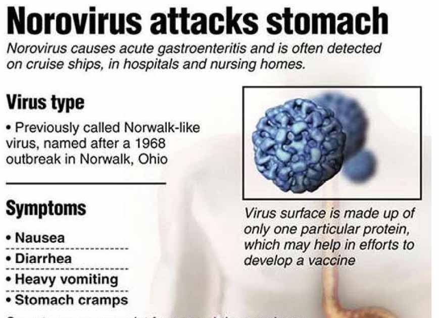 UK's ‘Norovirus’ infection | PT's IAS Academy
