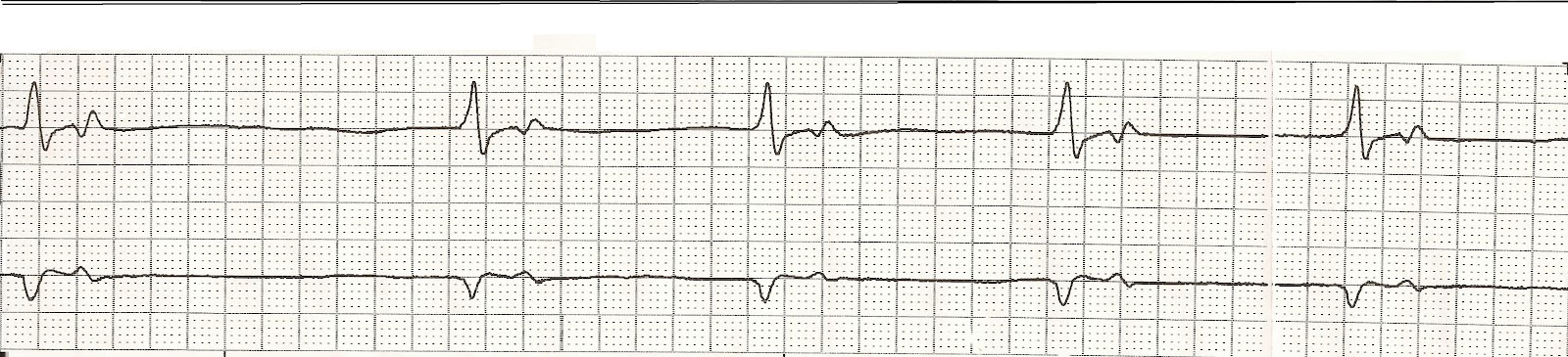 For in that sleep of death what dreams may come...