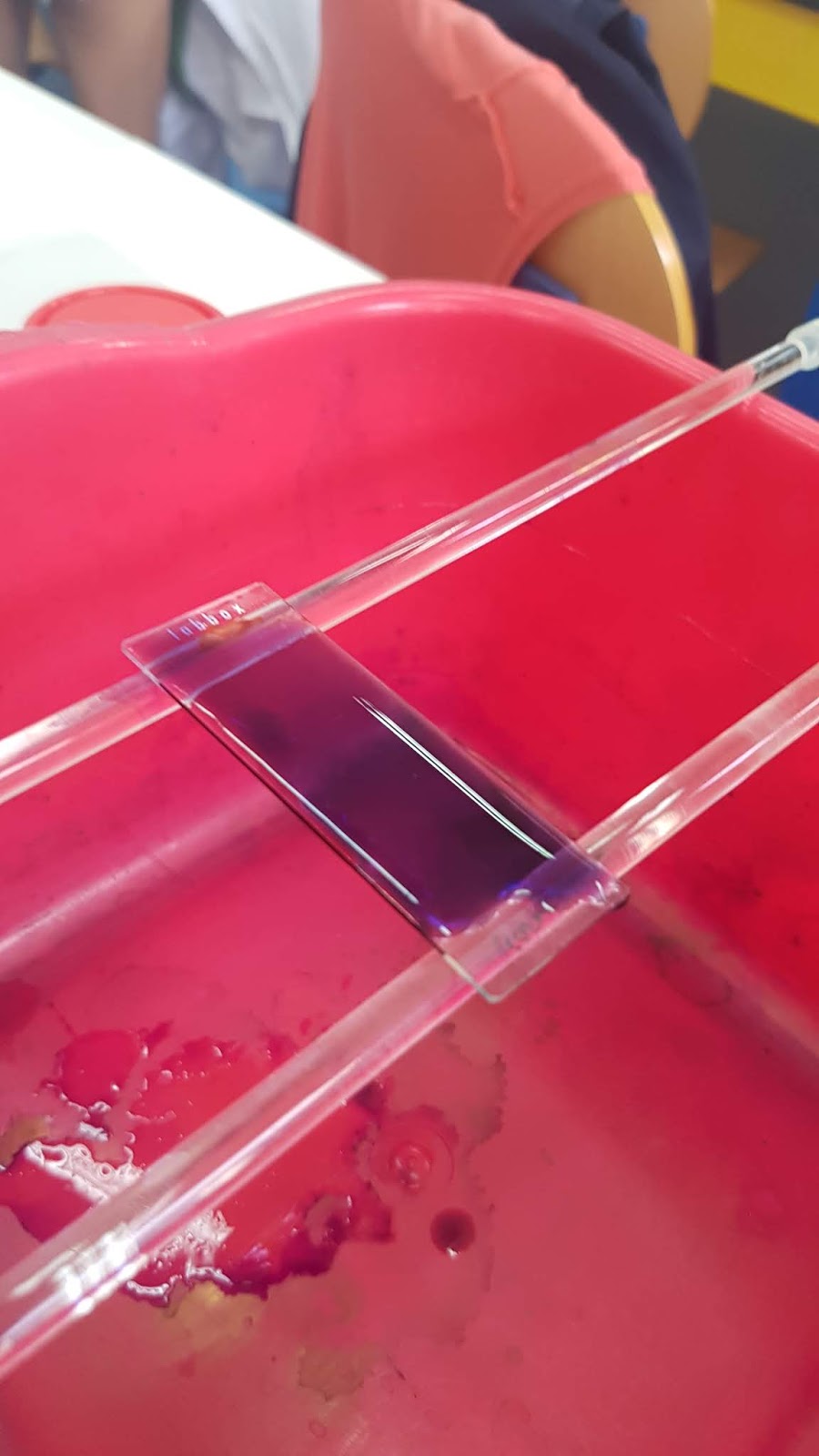 Hematología: Práctica 3: Tinción con Giemsa