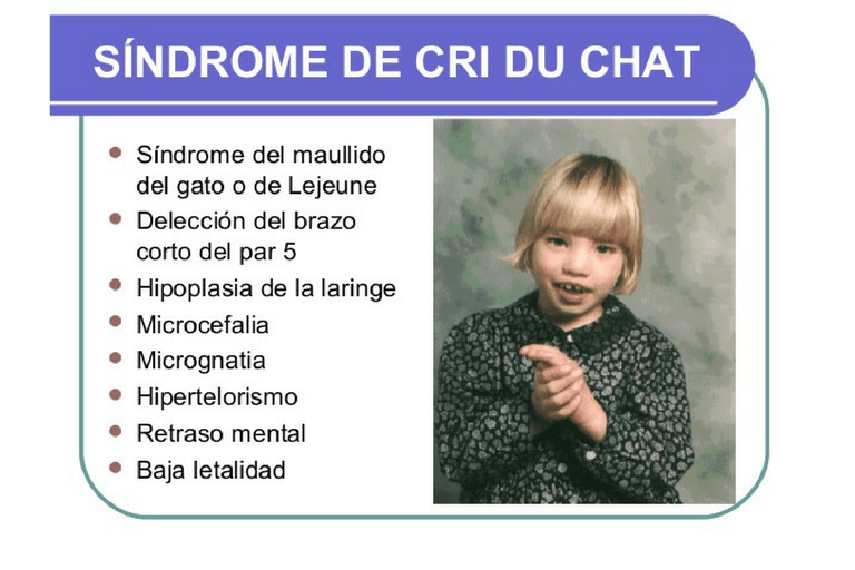 Enfermedades Raras, ¿y eso de qué va?: SÍNDROME "CRI-DU-CHAT"