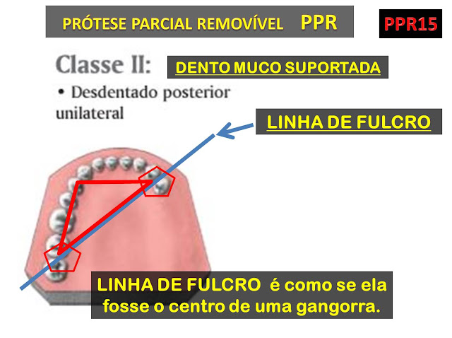 Professor Gilmar Zukowski gilmarprotese.blogspot.com : 3ºANO PPR ...