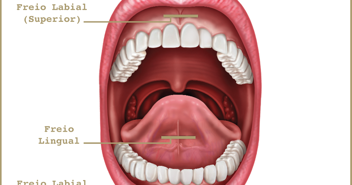 Frenectomia Língual e/ou Labial