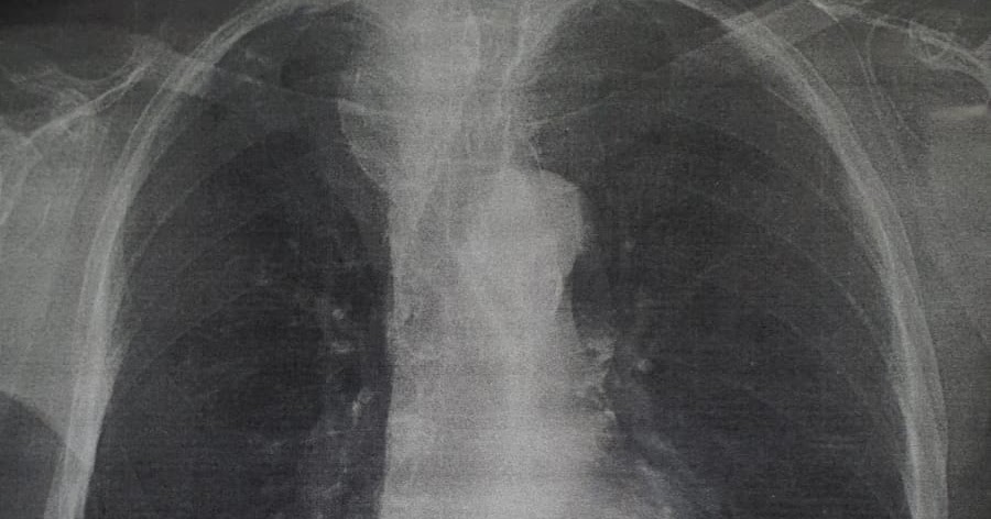 EL RINCÓN DE LA MEDICINA INTERNA. juanpedromacaluso@yahoo.com.ar: MUJER ...