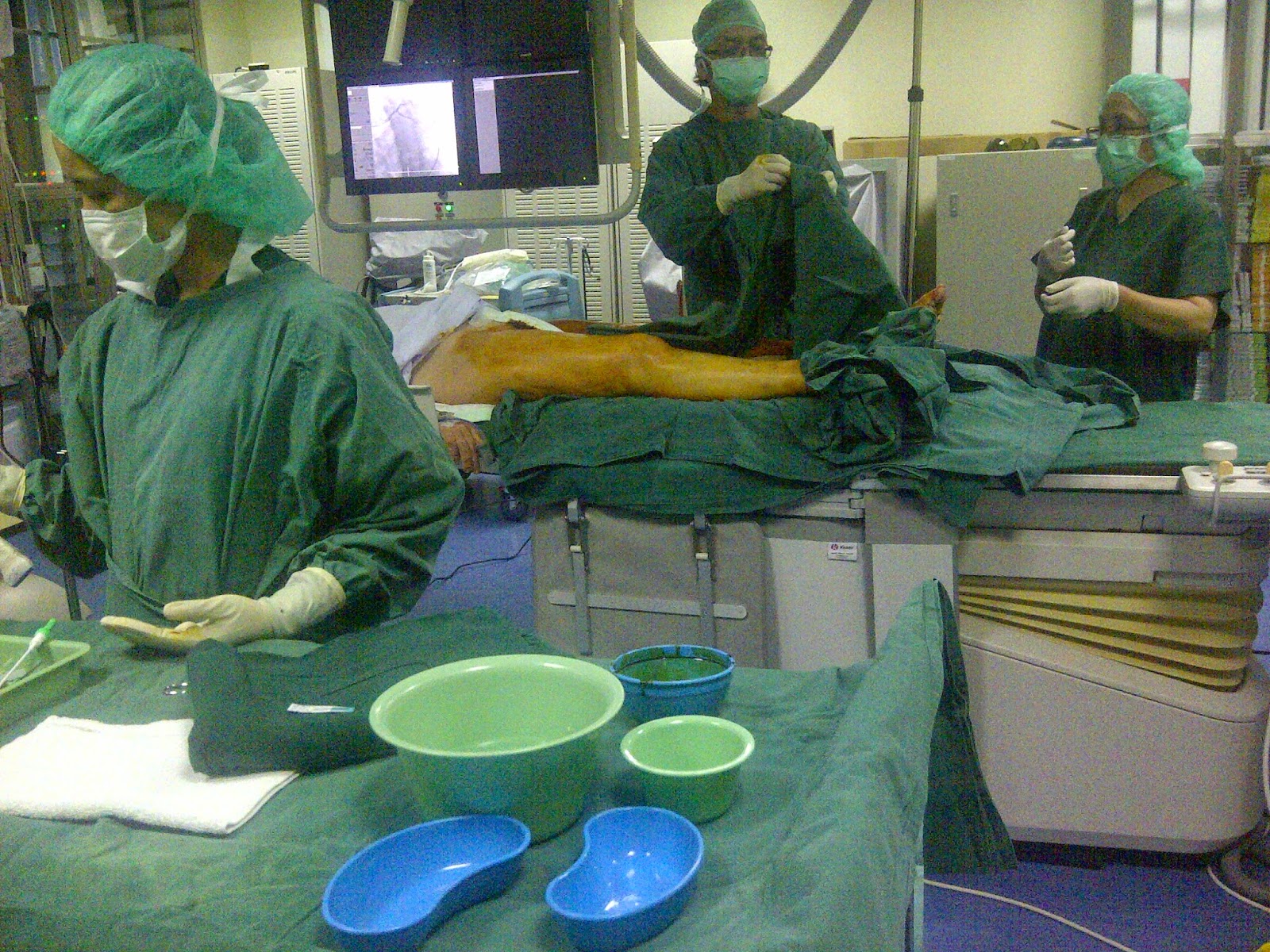 Spesialis Bedah Vaskular dan Endovaskular: Varises Vena Tungkai ...