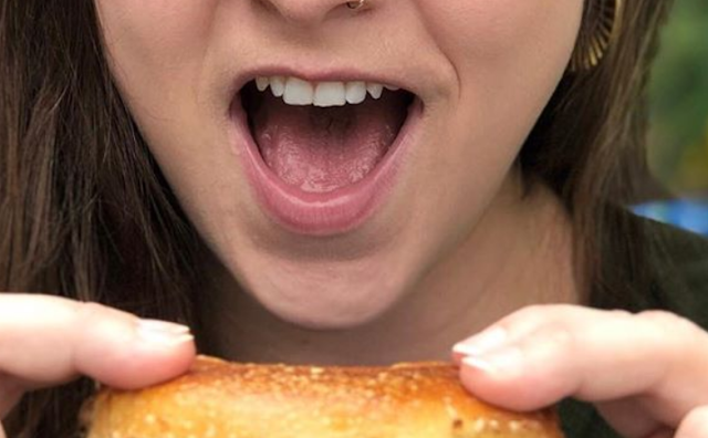 Greatest Escapist: Smile Big: I Got My Two Front Teeth Fixed!