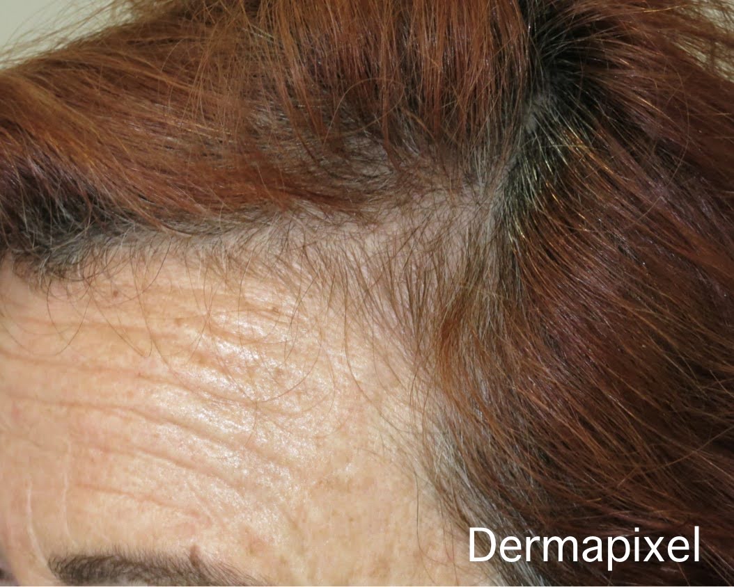 Dermapixel: febrero 2021