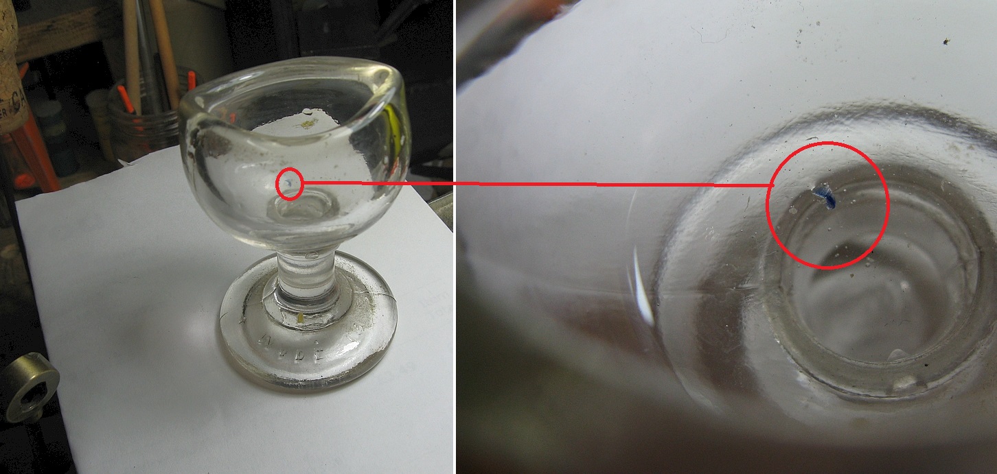 Teddy Tour Teas: Glass splinter in Eye