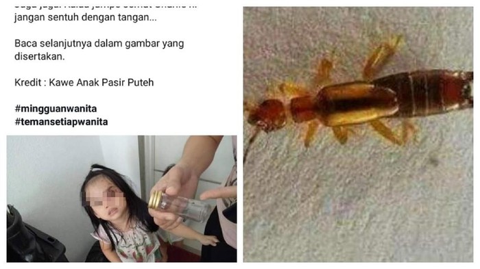 Crowded Broadcast 'Charlie Ants' Skin Bite, What Are Animals? - Human ...