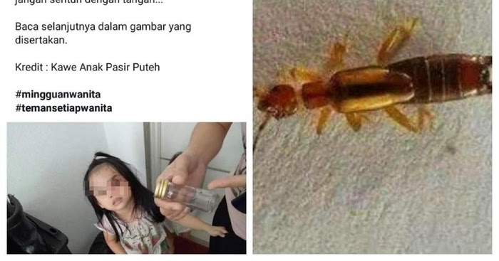 Crowded Broadcast 'Charlie Ants' Skin Bite, What Are Animals? - Human ...