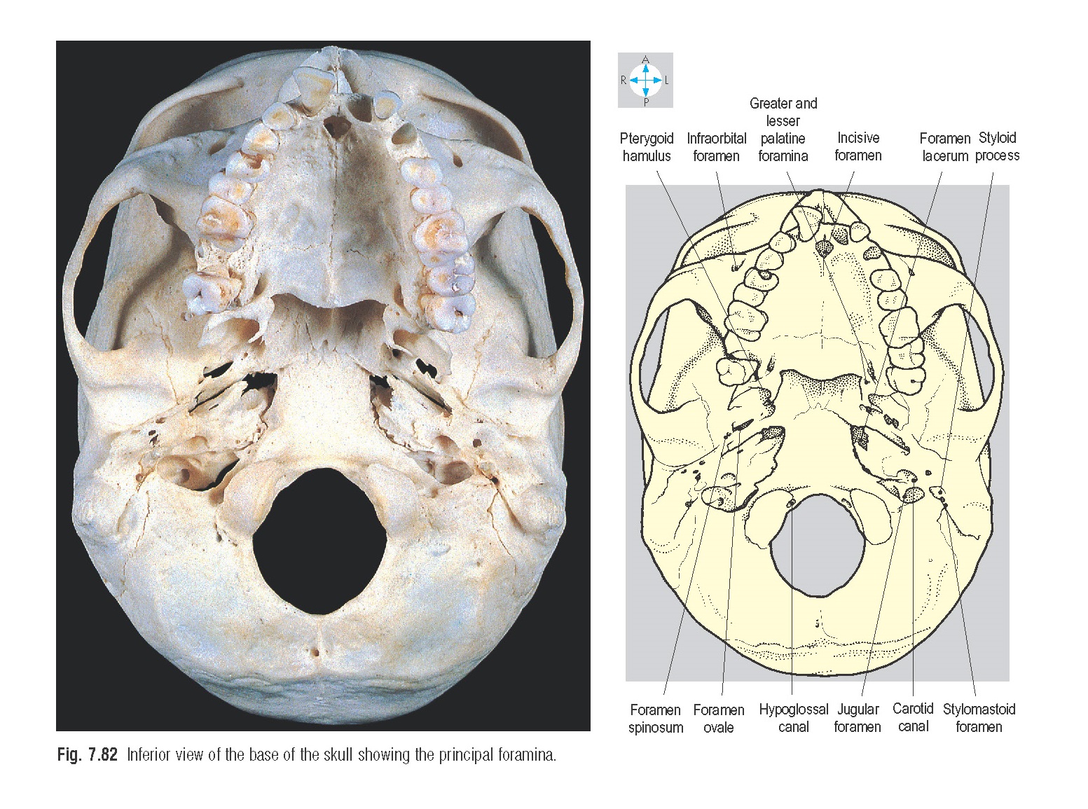 Cranium and Contents Anatomy - pediagenosis