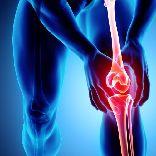 Knee Pain - Ligament Injuries Decoded