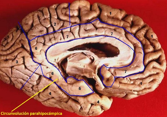 de la circunvolución