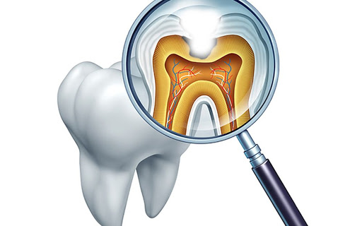 What is the difference between pulpotomy and pulpectomy? - OdontoVida