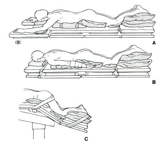 Taysir assistance الإسعاف الطبي تيسير: Décubitus ventral