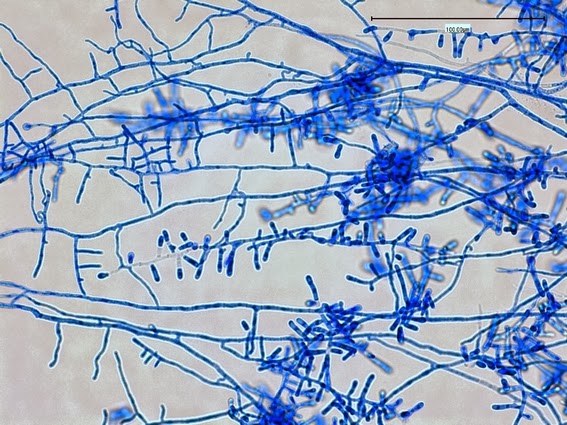 Fun With Microbiology (What's Buggin' You?): Trichophyton terrestre
