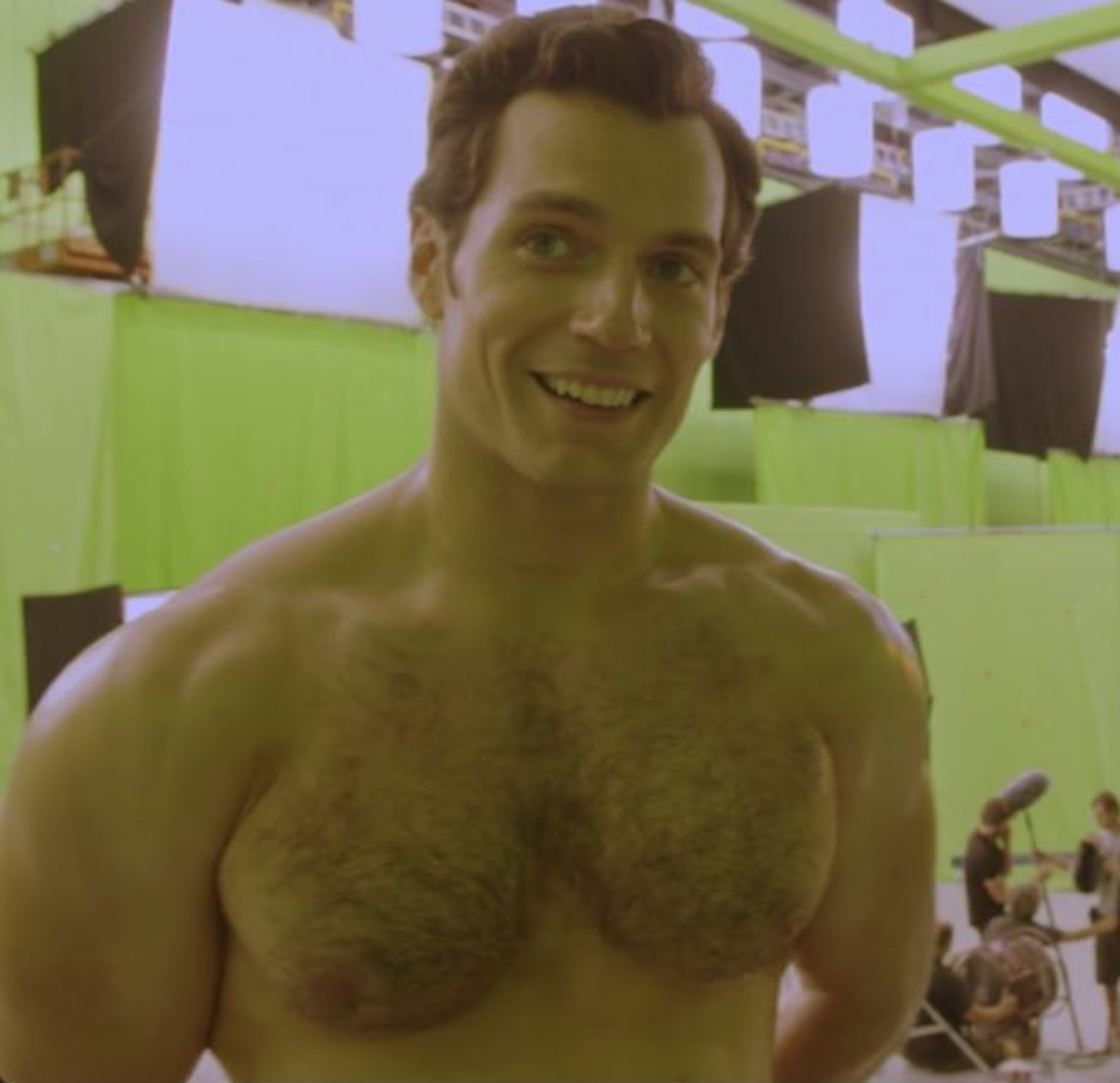 Pectoral Implants Celebrity