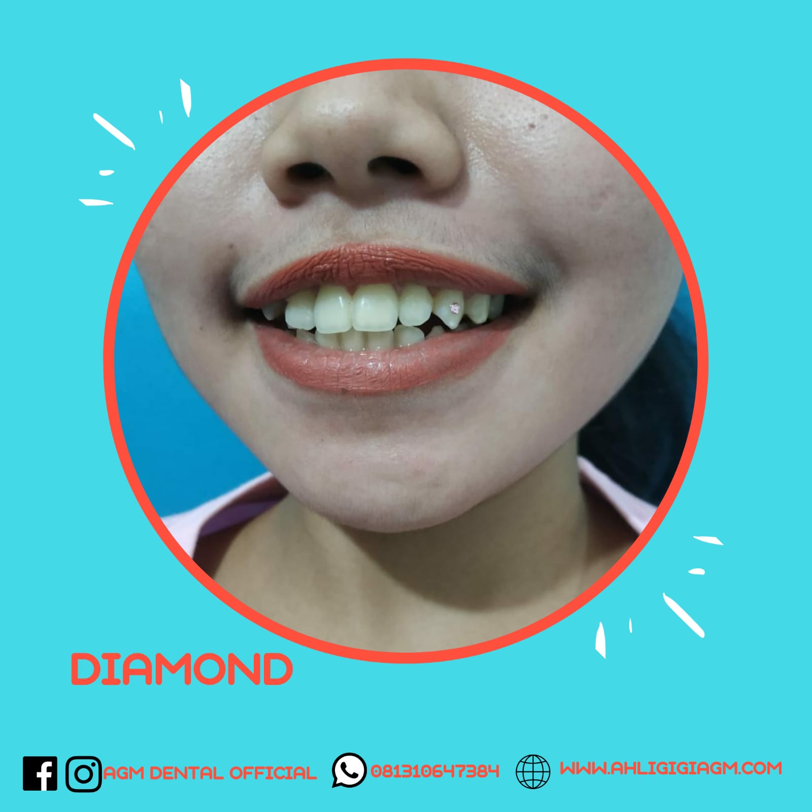 GIGI DIAMOND - AGM AHLI GIGI M ALI
