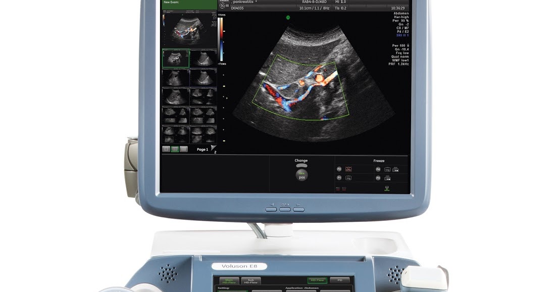 Ultrasound Scanners For Sale and Color Doppler Systems