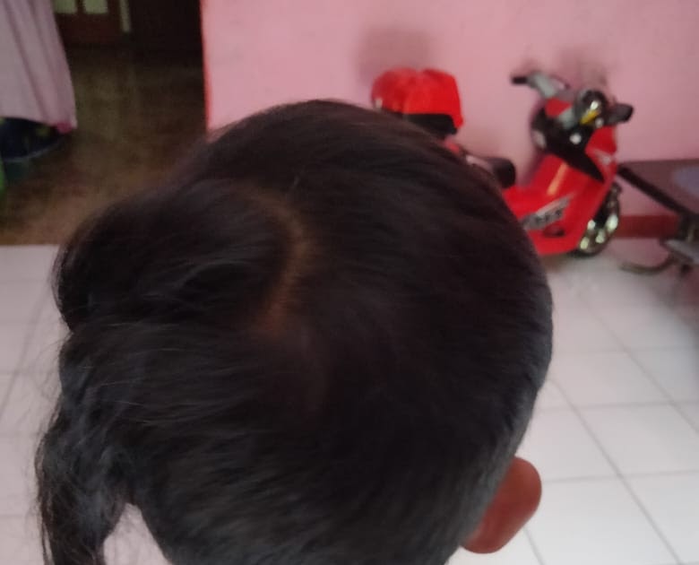 potong rambut kuncung - Cameron Rees