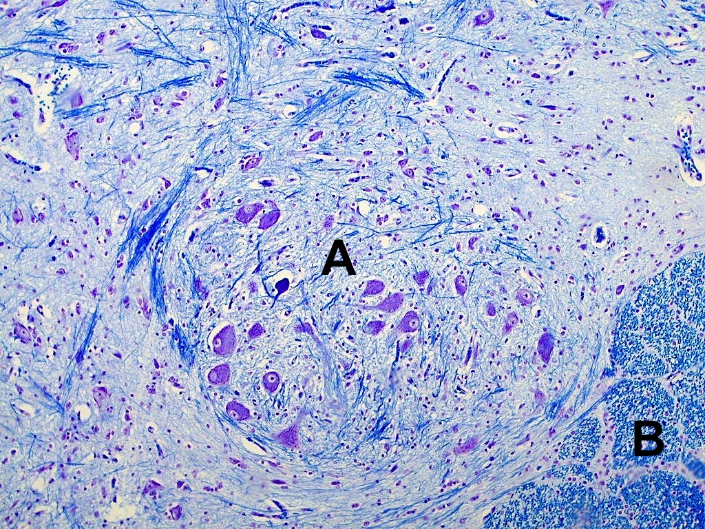 SOS BIOLOGIA CELULAR Y TISULAR: TEJIDO NERVIOSO. MEDULA ESPINAL ... SOS BIOLOGIA CELULAR Y TISULAR: TEJIDO NERVIOSO. MEDULA ESPINAL ...