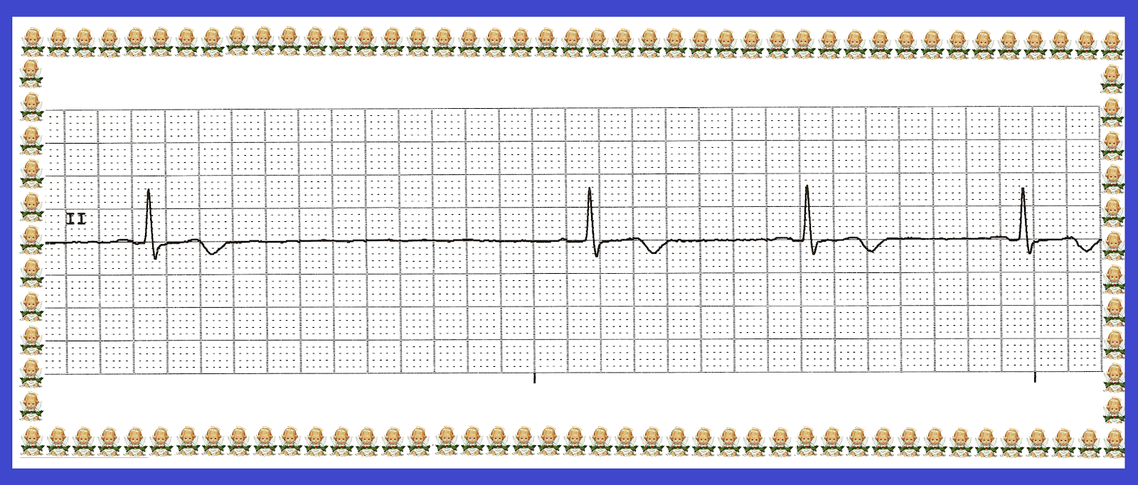Practice EKG Strips Merry Christmas