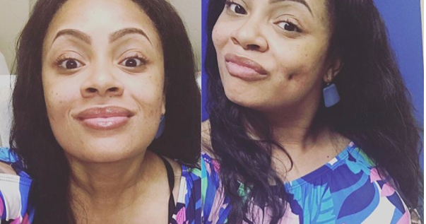 Latest Updates: The new craze ! Ladies are getting artificial dimples ...