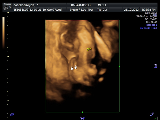 Bunga & Langit: pregnancy week 31 and 3D/4D scan