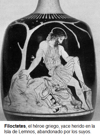 econoblognet: Filoctetes