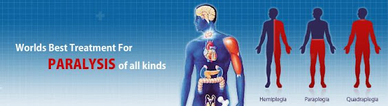 Treatment for Paralysis: What is Paralysis?