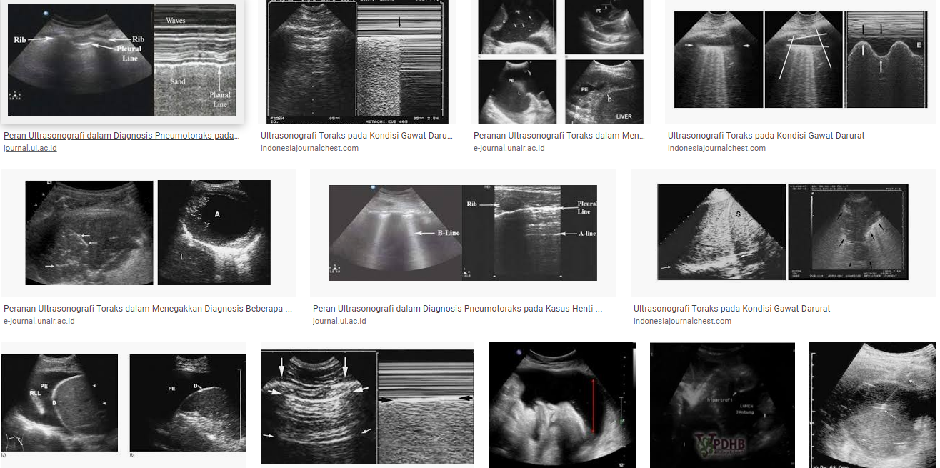 All About Amazing Math: Materi